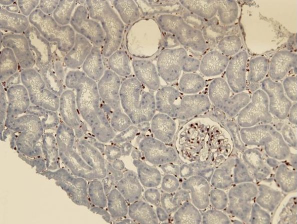 MOLECULAR DIAGNOSIS - AnyGenes