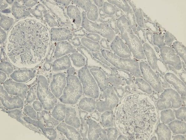 MOLECULAR DIAGNOSIS - AnyGenes