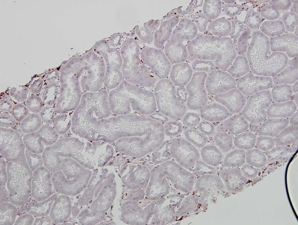 MOLECULAR DIAGNOSIS - AnyGenes